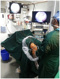 ACL Injury - aadyaorthohospital.com